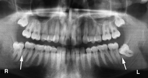 Carranza's Clinical Periodontology