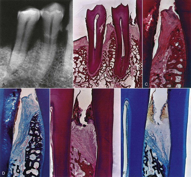 Carranza's Clinical Periodontology