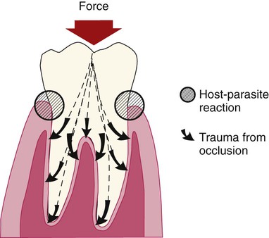 Carranza's Clinical Periodontology