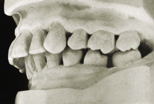 Carranza's Clinical Periodontology