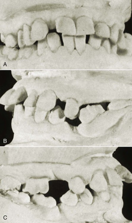 Carranza's Clinical Periodontology