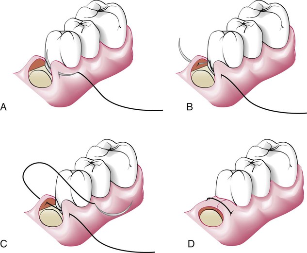 Carranza's Clinical Periodontology
