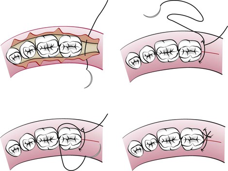 Carranza's Clinical Periodontology