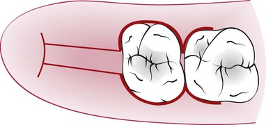 Carranza's Clinical Periodontology
