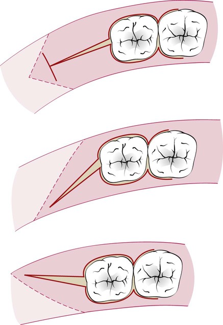 Carranza's Clinical Periodontology