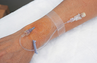 Phlebotomy Worktext and Procedures Manual