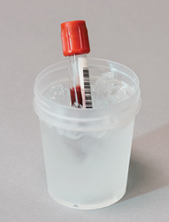 Phlebotomy Worktext and Procedures Manual