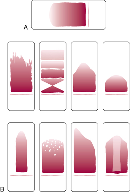 Phlebotomy Worktext and Procedures Manual