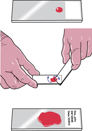 Phlebotomy Worktext and Procedures Manual