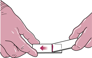 Phlebotomy Worktext and Procedures Manual