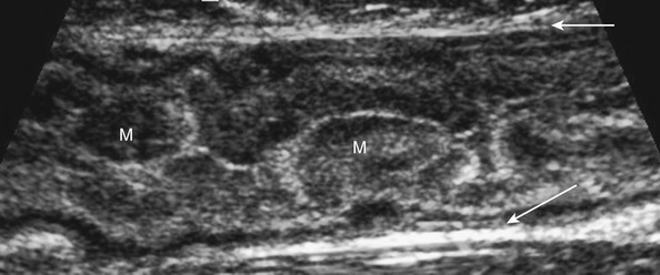 Textbook of Gastrointestinal Radiology