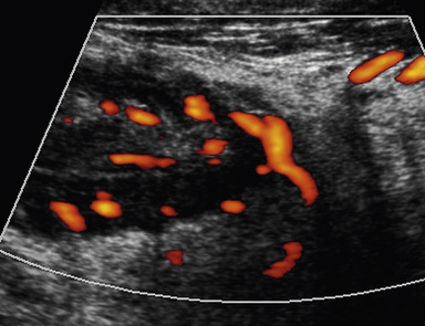 Textbook of Gastrointestinal Radiology