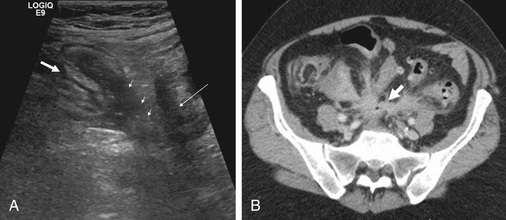 Textbook of Gastrointestinal Radiology