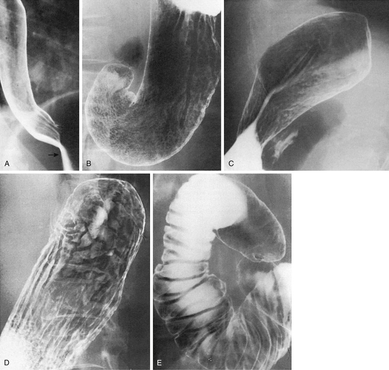 Textbook of Gastrointestinal Radiology
