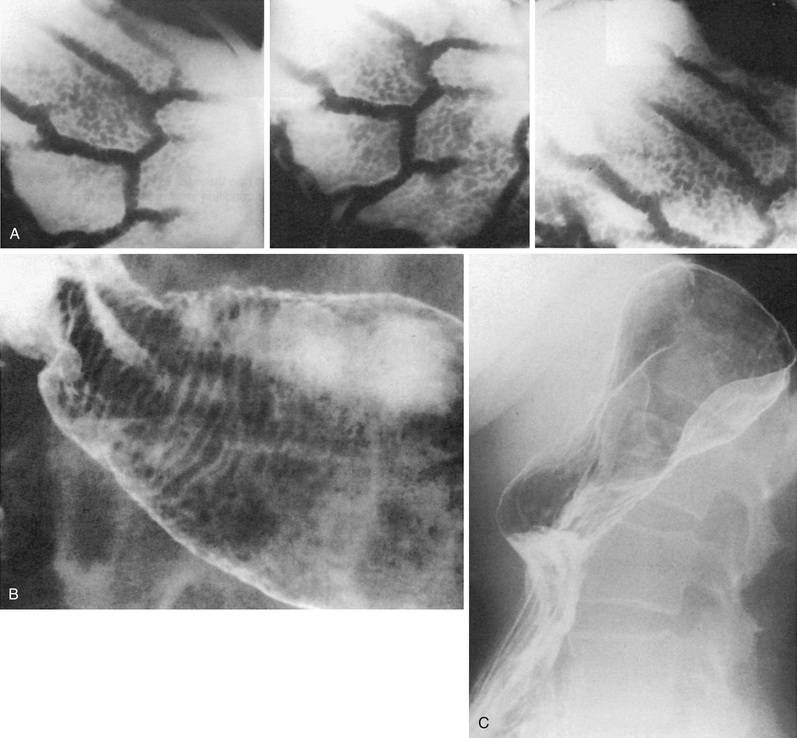 Textbook of Gastrointestinal Radiology