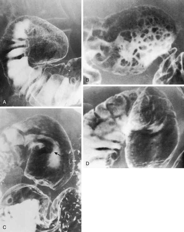 Textbook of Gastrointestinal Radiology