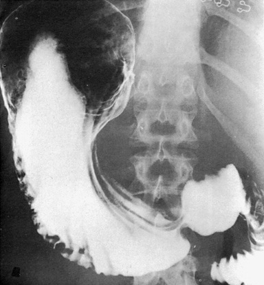 Textbook of Gastrointestinal Radiology