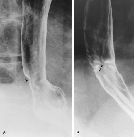 Textbook of Gastrointestinal Radiology