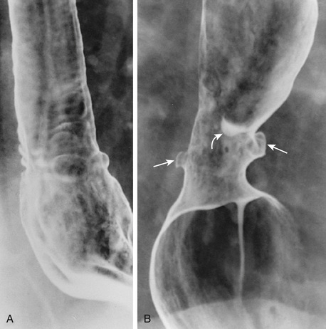 Textbook of Gastrointestinal Radiology