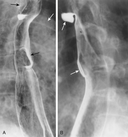 Textbook of Gastrointestinal Radiology