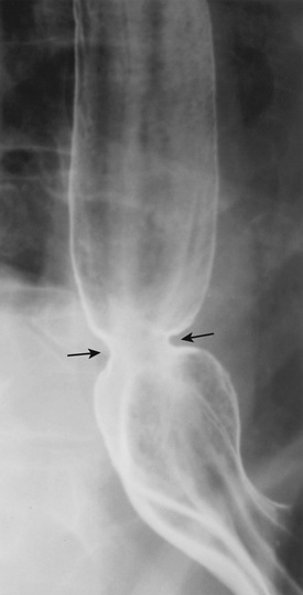 Textbook of Gastrointestinal Radiology
