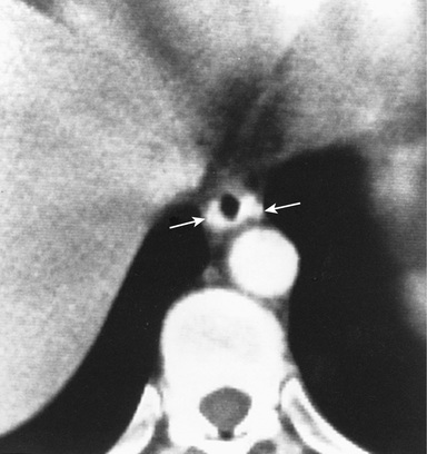 Textbook of Gastrointestinal Radiology
