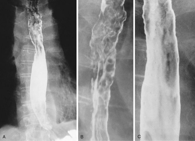 Textbook of Gastrointestinal Radiology