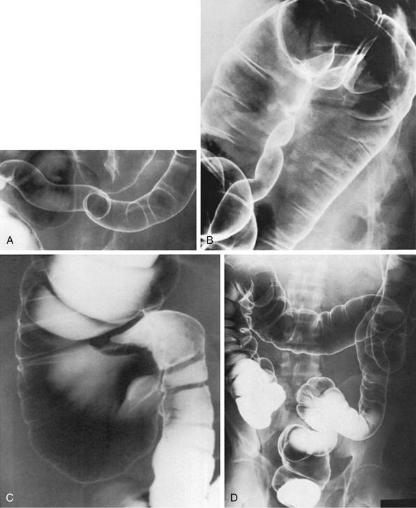 Textbook of Gastrointestinal Radiology