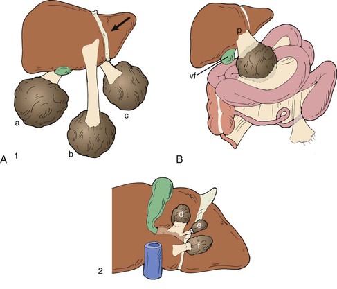 Textbook of Gastrointestinal Radiology