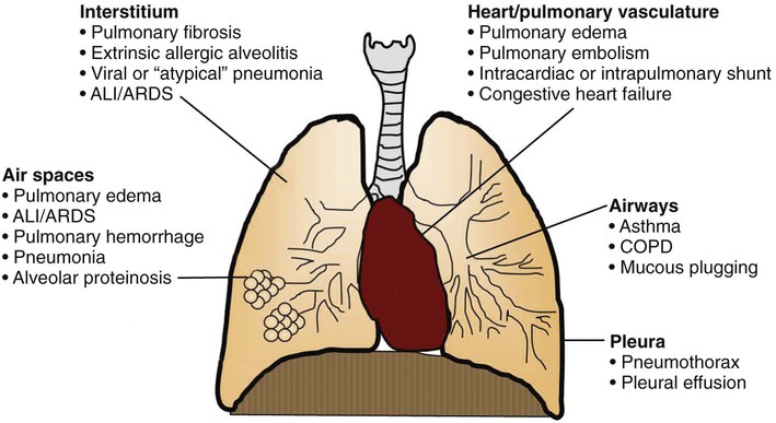 Murray & Nadel's Textbook of Respiratory Medicine