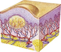 Care of the Patient With an Integumentary Disorder