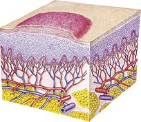 Care of the Patient With an Integumentary Disorder