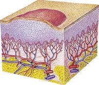 Care of the Patient With an Integumentary Disorder