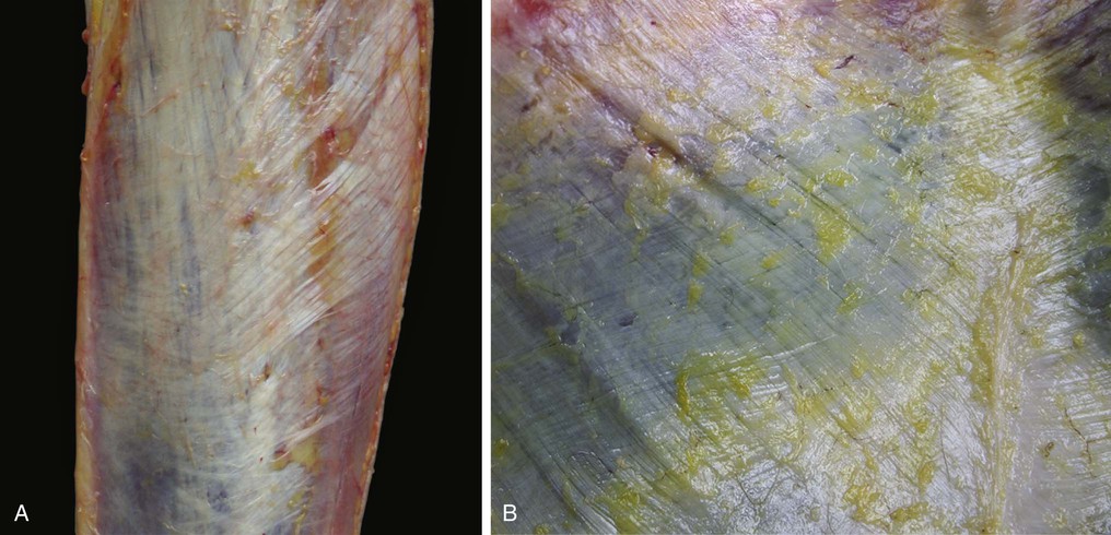 Functional Atlas of the Human Fascial System
