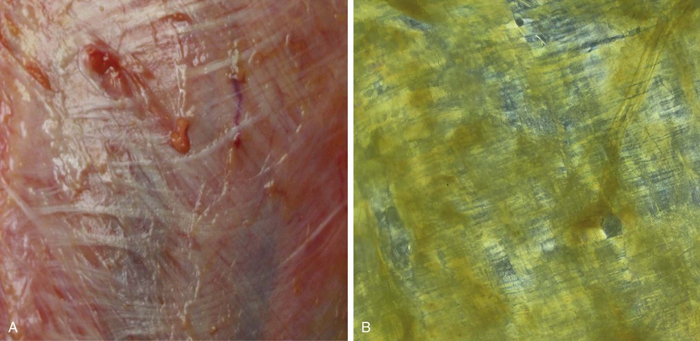Functional Atlas of the Human Fascial System