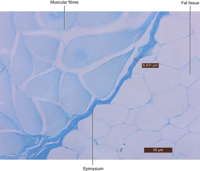 Functional Atlas of the Human Fascial System