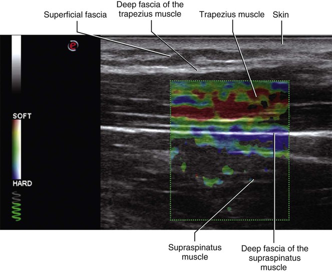 Functional Atlas of the Human Fascial System