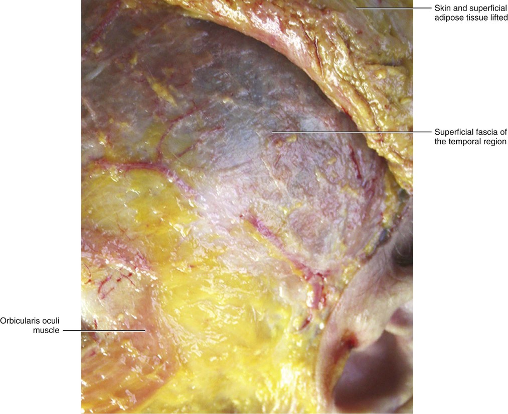 Functional Atlas of the Human Fascial System