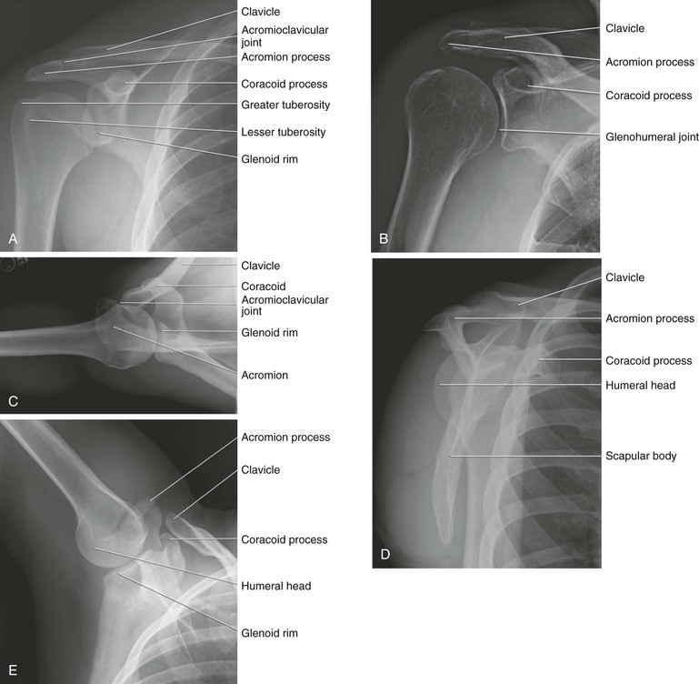Glenohumeral Joint Imaging*