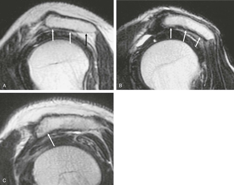 Glenohumeral Joint Imaging*
