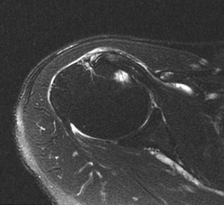 Glenohumeral Joint Imaging*