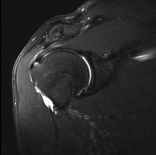 Glenohumeral Joint Imaging*