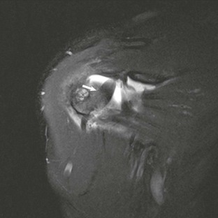 Glenohumeral Joint Imaging*