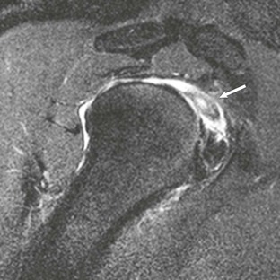 Glenohumeral Joint Imaging*