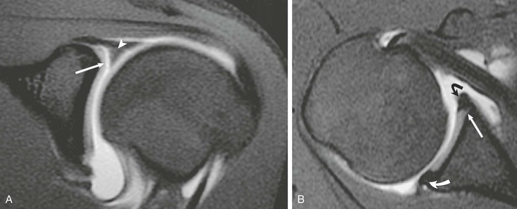 Glenohumeral Joint Imaging*