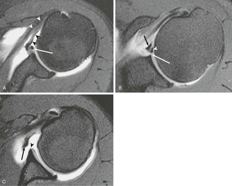 Glenohumeral Joint Imaging*