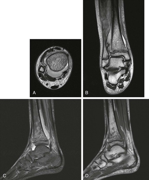 Imaging Considerations in the Skeletally Immature Patient