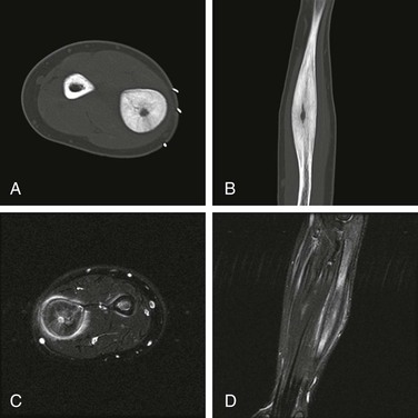 Imaging Considerations in the Skeletally Immature Patient