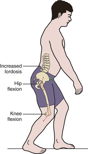 Essentials of Kinesiology for the Physical Therapist Assistant