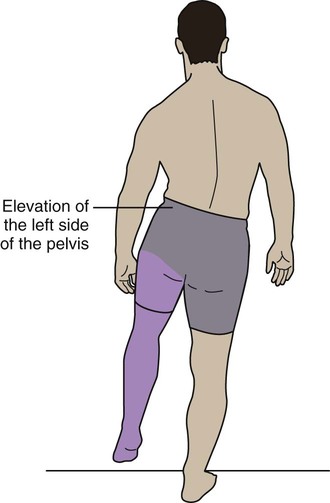 Essentials of Kinesiology for the Physical Therapist Assistant